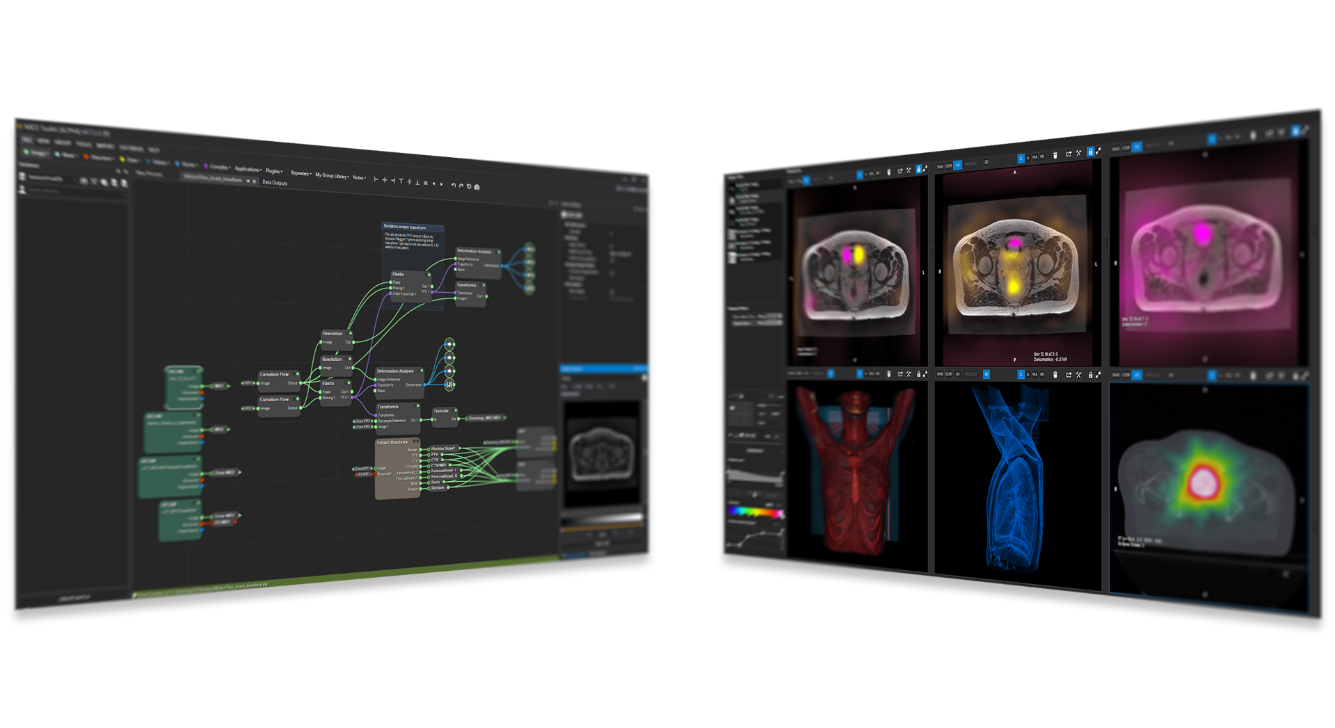 Global lansering för Hero Imagings mjukvara för medicinsk forskning – Uminova Innovation